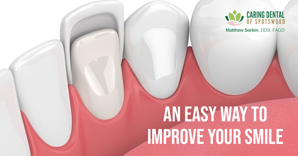 An Easy Way to Improve Your Smile - Caring Dental of Spotswood